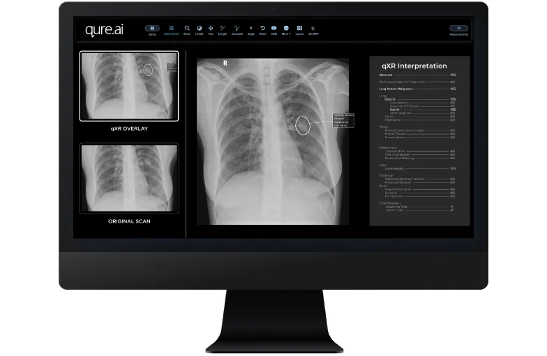 Vertice Mobile Healthcare