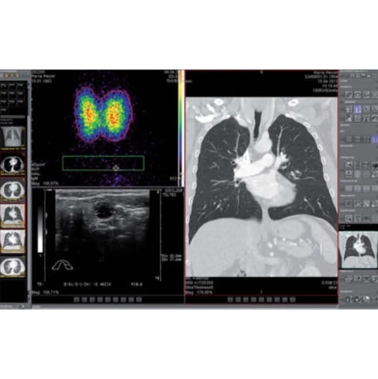 Vertice Mobile Healthcare