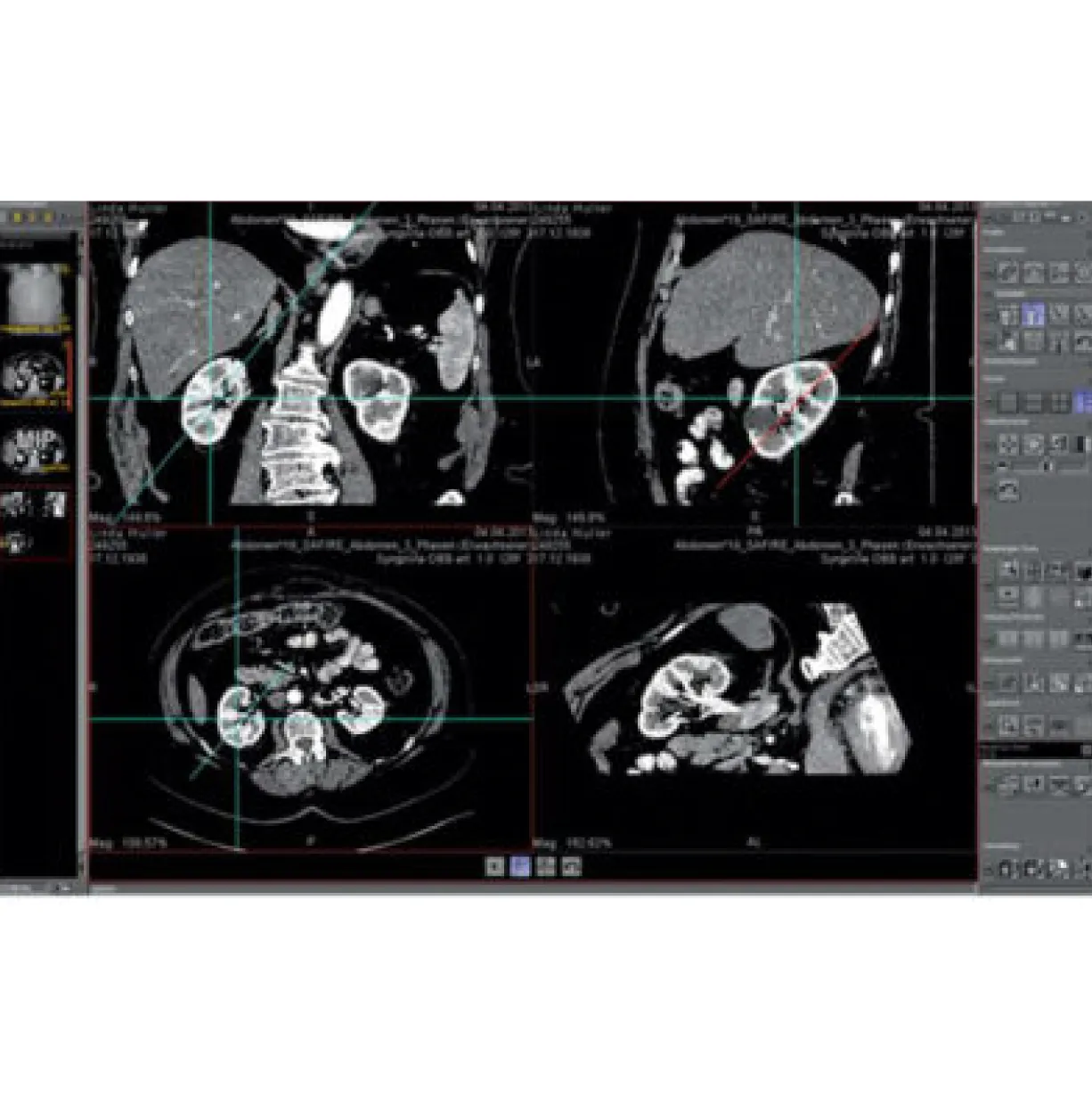 Vertice Mobile Healthcare